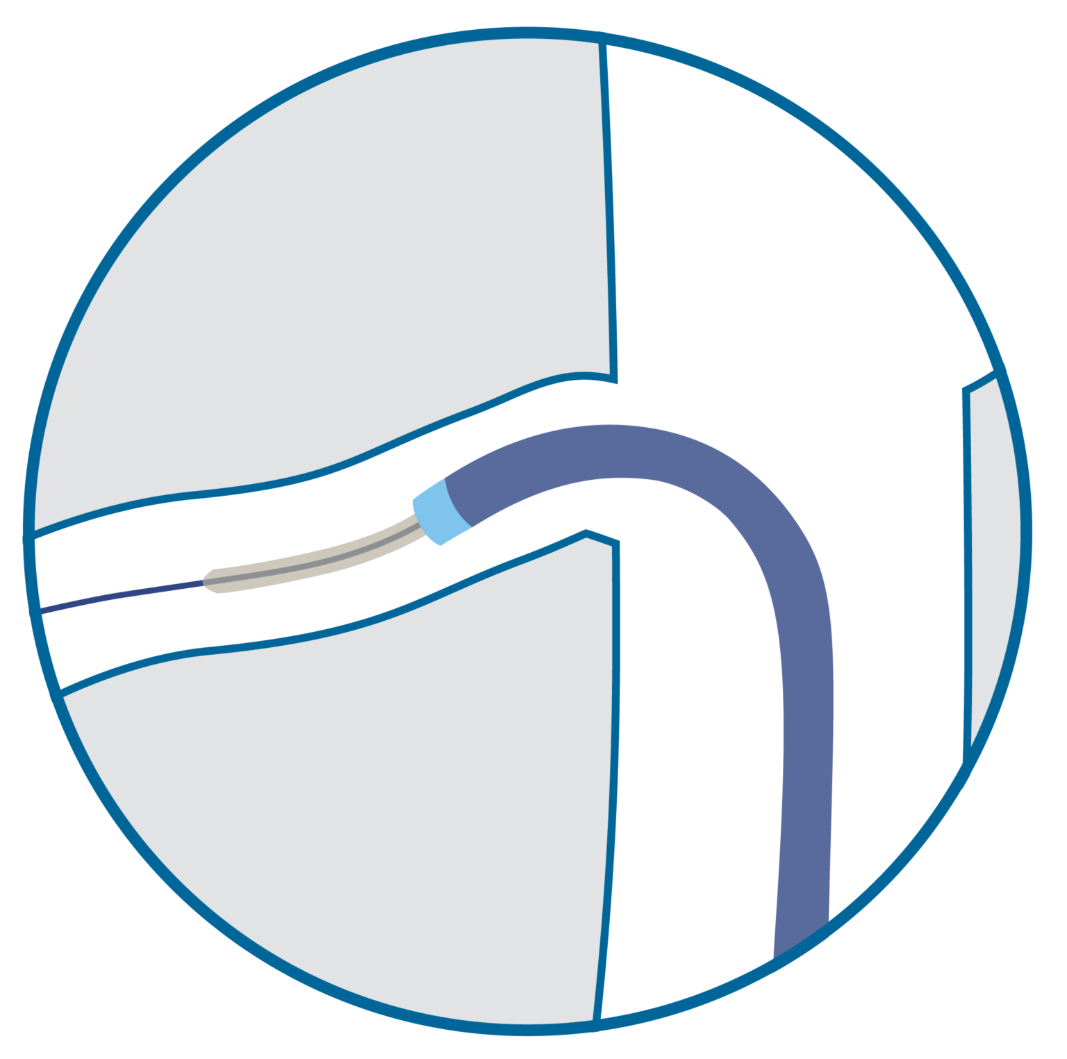 Passport® Steerable Sheath | Cannulate Contralateral Access | Renal ...