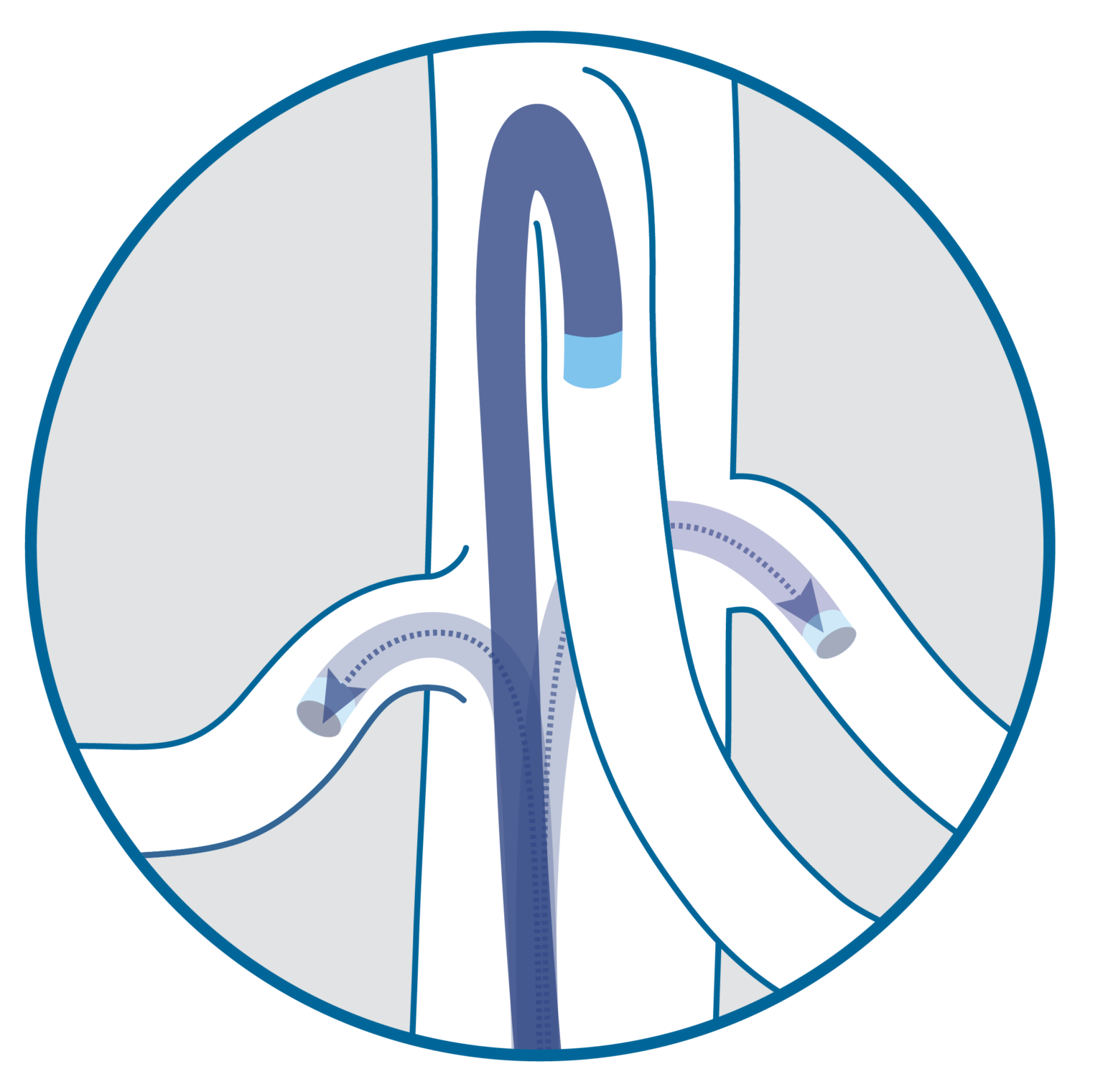 Passport® Steerable Sheath | Cannulate Contralateral Access | Renal ...
