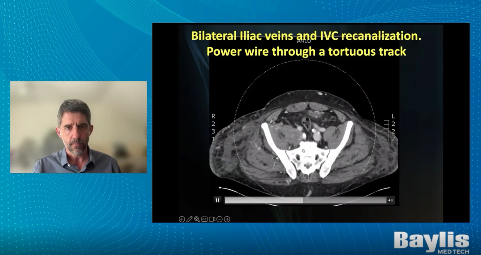 Education - Baylis Medical Technologies